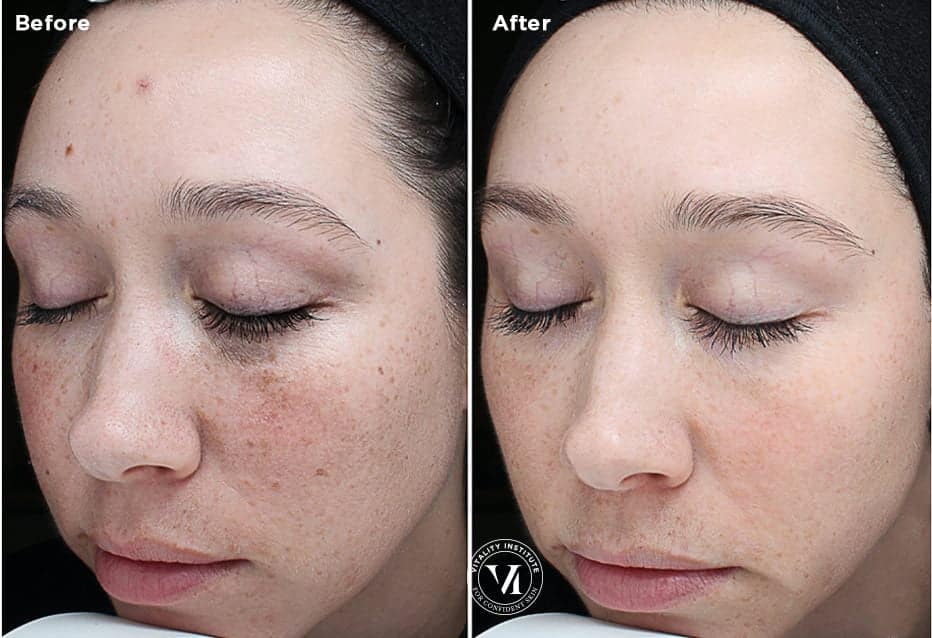 No.1 Skin Clinic & Aesthetics Skin Care in Bradford
